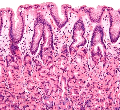 Prepared Microscope Histology Slides for Medical Education - Warp ...